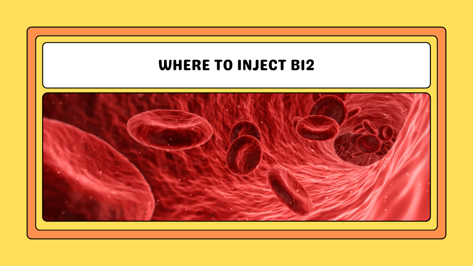 Where to Inject B12 | Best Injection Sites & Guide